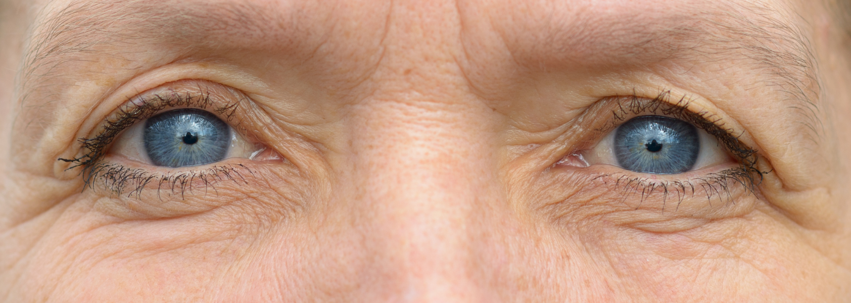 Auckland Eye Research: Advancing Ophthalmology through Clinical Trials
