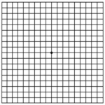 Amsler Grid Eye Test | Auckland Eye Online Check